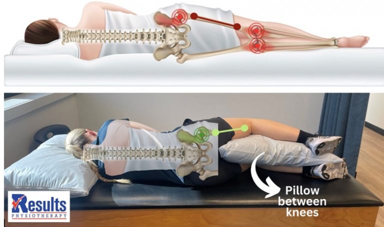 Lateral Hip Pain | Results Physiotherapy Chandler